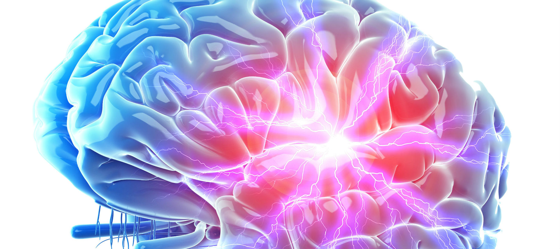 tACS | Vanguard Center for Neurological Health (VCNH)